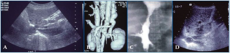 Venous embryology: the key to understanding anomalous venous conditions ...