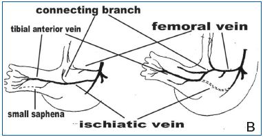 Venous embryology: the key to understanding anomalous venous conditions ...