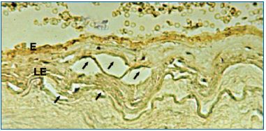 Venous endoscopy - Servier - PhlebolymphologyServier – Phlebolymphology