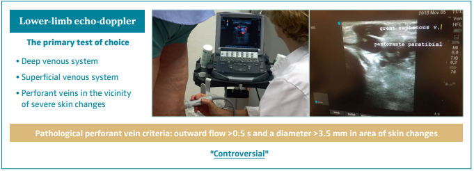 Management of hypodermitis or lipodermatosclerosis: an up-to-date ...